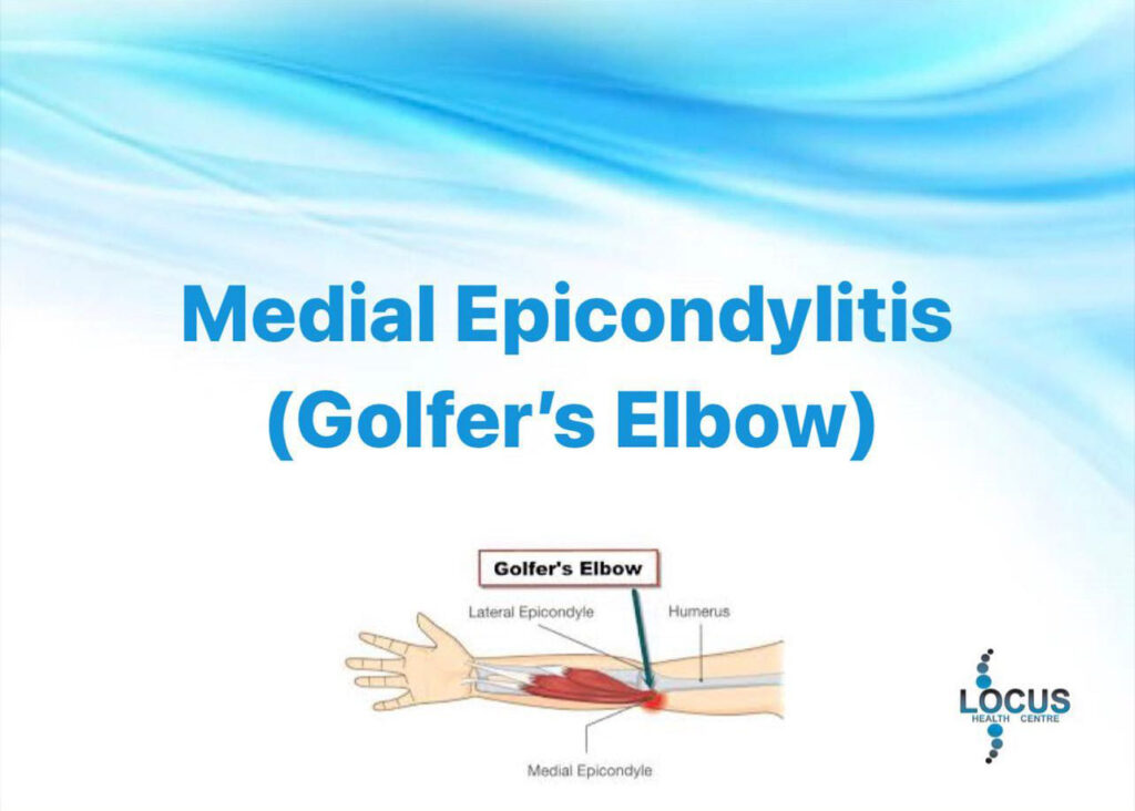 MEDIAL EPICONDYLITIS